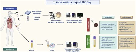 Liquid Biopsy For Advanced NSCLC A Consensus Statement From The
