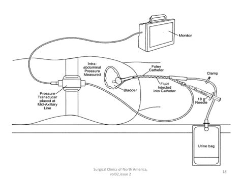 Hypoperfusion Shock States And Abdominal Compartment Ppt Free