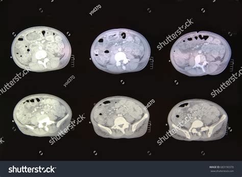 Mri Scan Human Brain Stock Photo 683190370 Shutterstock
