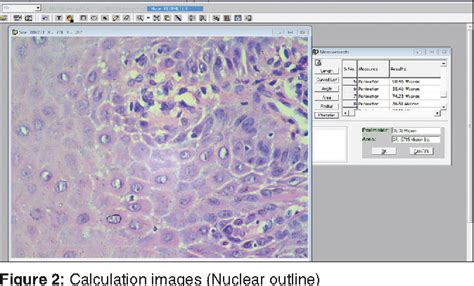 Figure 6 From Computer Assisted Morphometric Image Analysis Of Cells Of