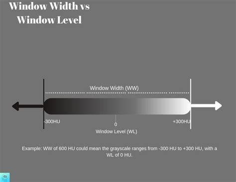 window width and window level my ct registry review