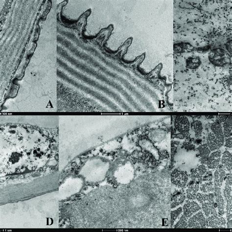Ultrastructure Of Aedes Aegypti Larvae L3 Treated With The Substance