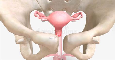 Chlamydia Is A Sexually Transmitted Infection Caused By Chlamydia