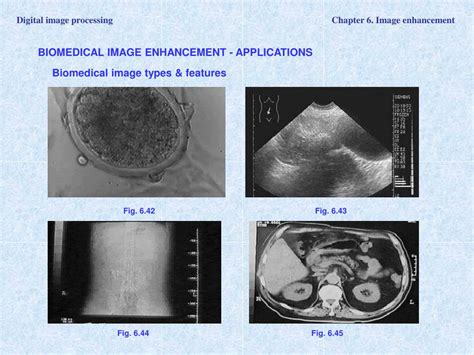 ppt digital image processing chapter 6 image enhancement powerpoint