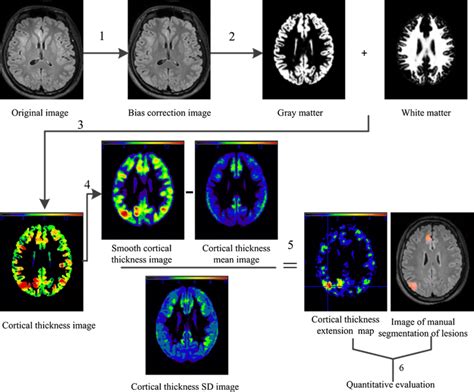 overview of the image processing steps for identifying lesions based on