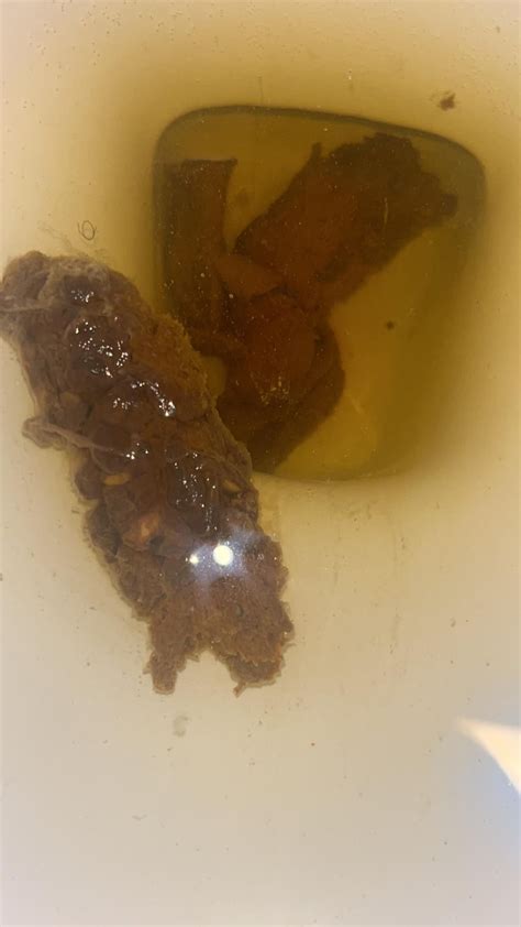 Infection Stool Rpoop