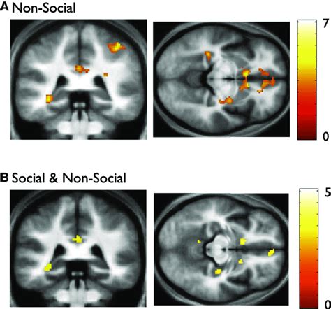 Learn Phase Fmri Results Neural Activity In The Posterior