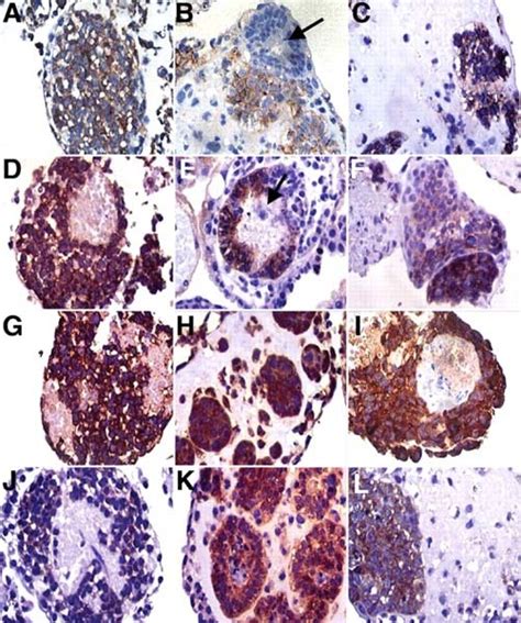 In Vitro Differentiation Of Mouse Embryonic Stem Cells Enrichment Of