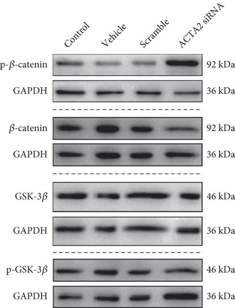 Acta2 Downregulation Promoted β Catenin Accumulation Through