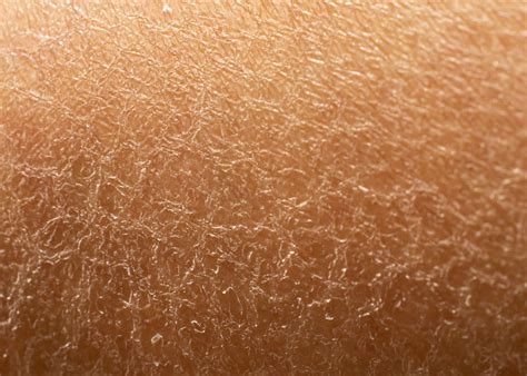 Dull Dry Skin Treat Dull Skin Leeds Dry Skin Treatment Leeds