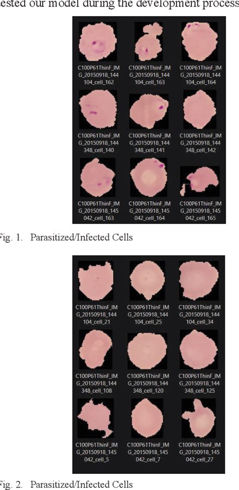 Figure 3 From Malaria Cell Image Classification Using Autoencoder