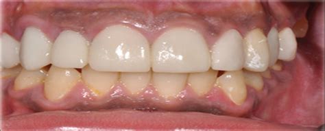 Journal Of Datta Meghe Institute Of Medical Sciences University