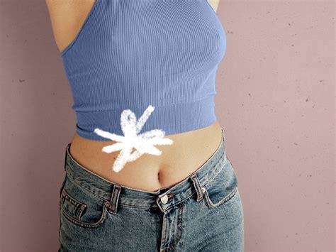 Abdominal Soft Tissue Sarcoma What To Know