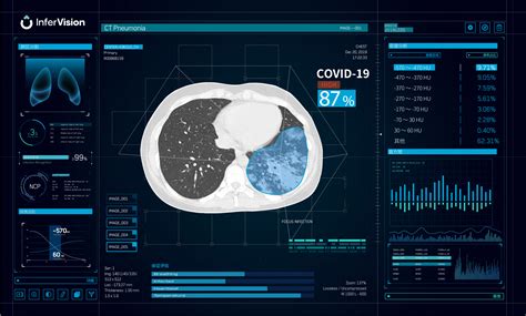 Fda Green Lights Infervisions Deep Learning Tool For Segmenting Lung