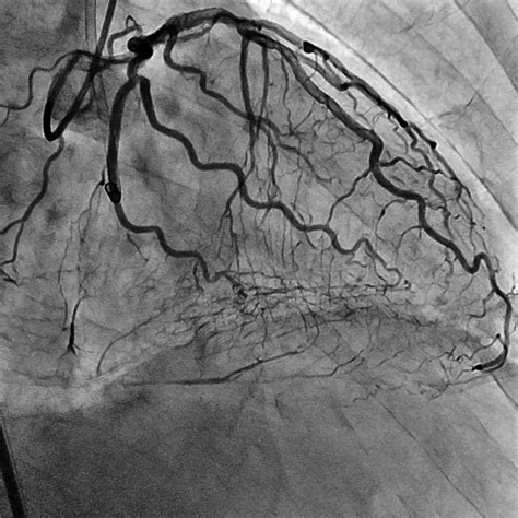 Trinias Unity Edition B8 C8 F8 Shimadzu Europa Medical