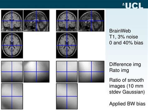 Ppt Nonrigid Image Registration Using Conditional Mutual Information