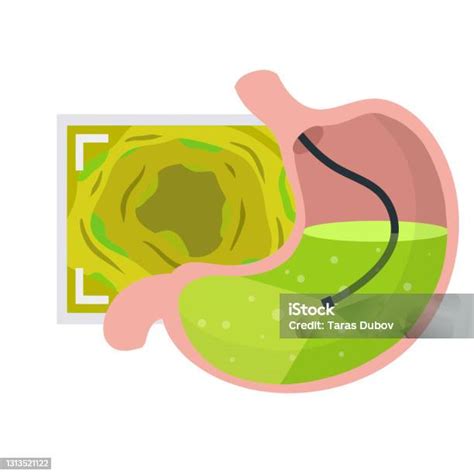 위내시경 내시경 검사 및 소화 문제 카메라와 호스 내부 장기와 절차 만화 평면 일러스트 위장의 의료 육안으로 검사 화면으로 모니터 스캔 건강 진단에 대한 스톡 벡터 아트 및