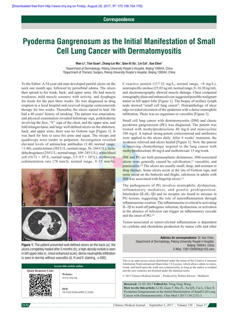 Pdf Pyoderma Gangrenosum As The Initial Manifestation Of Small Cell Lung Cancer With
