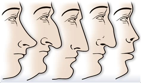 Nose Different Shapes