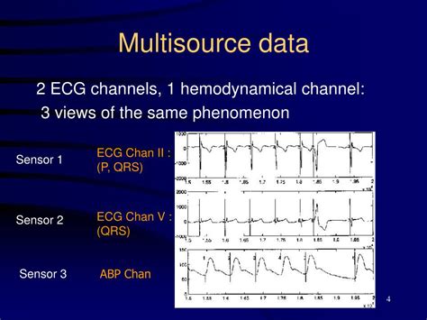 PPT Learning Rules From Multisource Data For Cardiac Monitoring PowerPoint Presentation ID