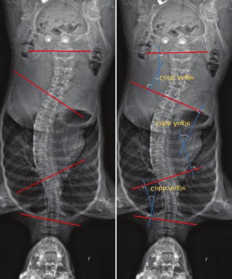 Before And After Correction Download Scientific Diagram