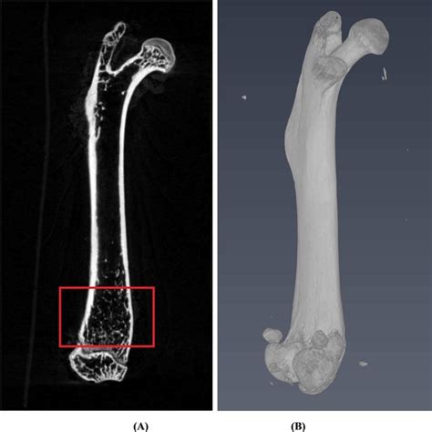 Volumetric Micro Ct Imags Of A Femoral Bone Depicting The