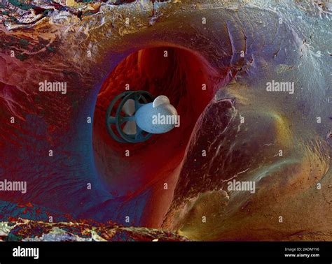 Micro Submarine In Artery Conceptual Coloured Scanning Electron Micrograph Of A Micro Submarine