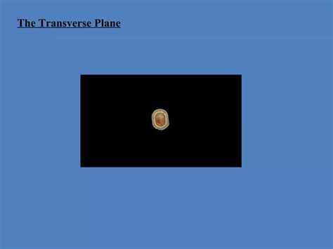 Anatomical Position And Basic Movements Ppt