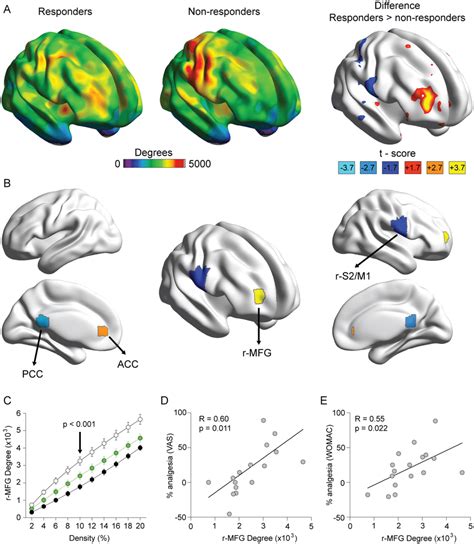 Patterns Of Brain Connectivity In Placebo Responders And Nonresponders