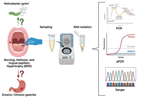 Helicobacter Pylori And Oral Pathology Intechopen