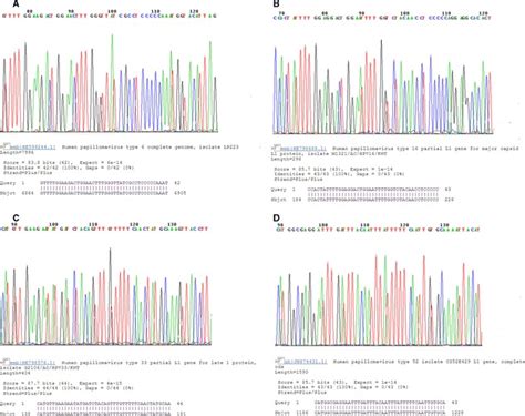 Four Hpv Genotypes Found In One Sample The My09my11 Primary Pcr