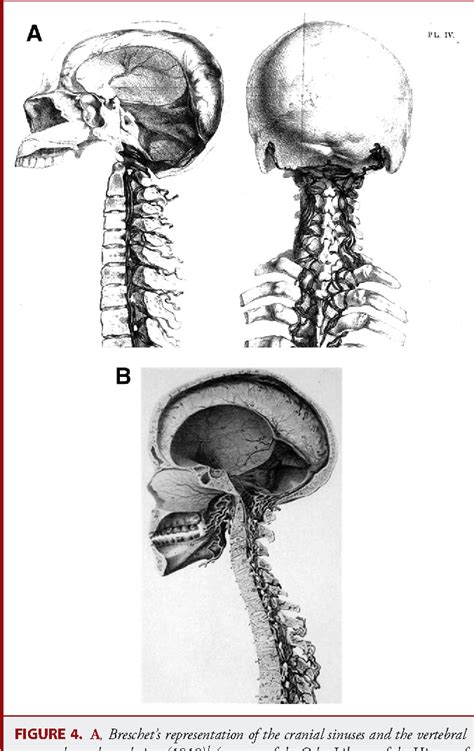 Figure 4 From History Of The Vertebral Venous Plexus And The Significant Contributions Of