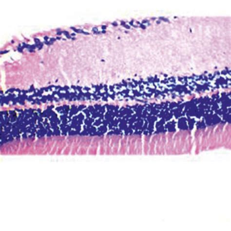 Observation Of The Retinal Structure Of Each Group By He Staining Download Scientific Diagram