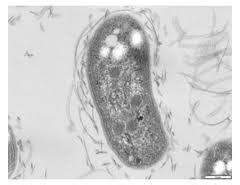 Biolofreak Eubacteria Archaebacteria