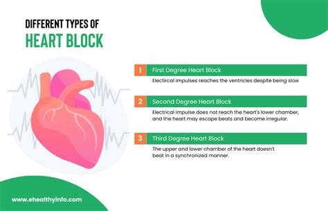 Heart Block Types Causes Symptoms And Treatment Options E Healthy Info