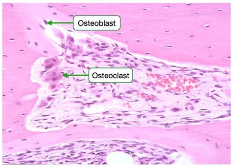 Structure And Function Of Connective Tissue And Bone Lab