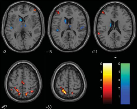 Regions Showing Significant Group Differences In The Sg Functional Download Scientific Diagram