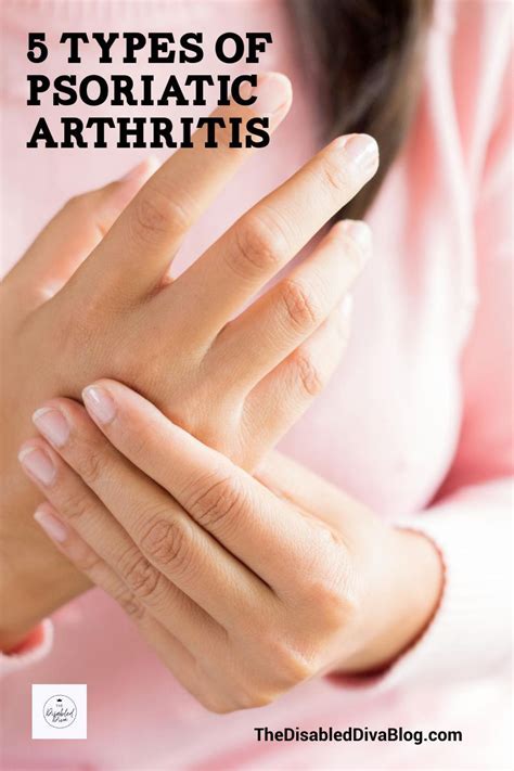 Five Types Of Psoriatic Arthritis Artofit