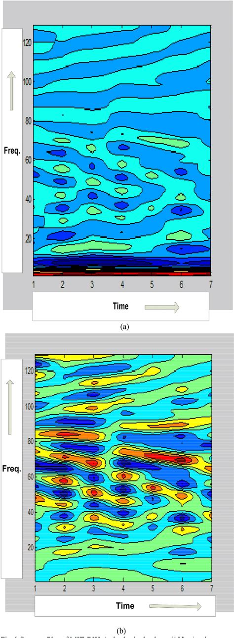 Contour Plot Of Mit Bih Arrhythmia Database 103 M Using Spectrogram Download Scientific