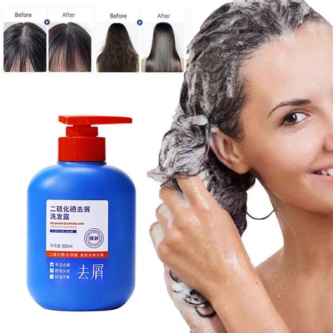 300ml Selenium Disulfide Suntan And Dandruff Removing Shampoo 300ml Selenium Disulfide Suntan And Dandruff Removing Shampoo