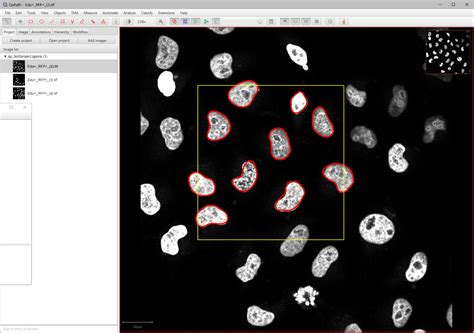 Export QuPath Annotations For StarDist Training Image Analysis