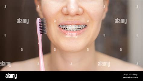 Girl With Braces On Her Teeth Brushing Her Teeth With A Toothbrush Close Up Dental And Oral