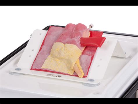 Vermiform Appendix Normal Anatomy Limbs And Things Global