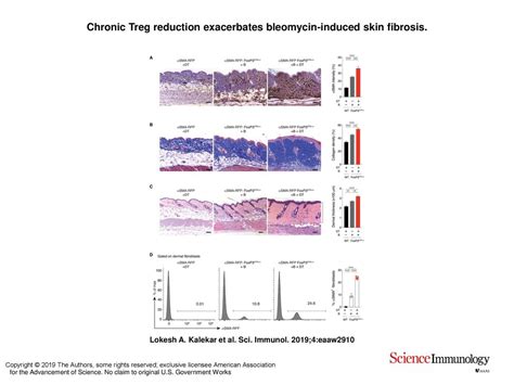 Chronic Treg Reduction Exacerbates Bleomycin Induced Skin Fibrosis Ppt Download