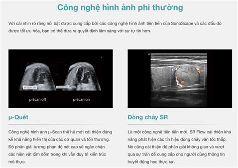Sonoscape P11 Elite Máy Siêu âm Sonoscape