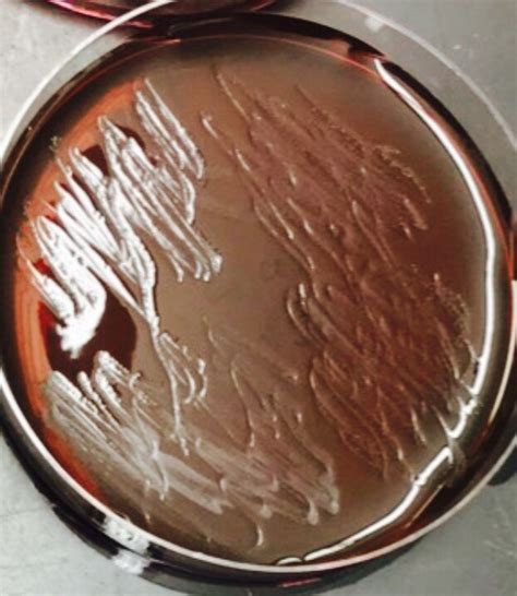 Differential Stains Flashcards Memorang