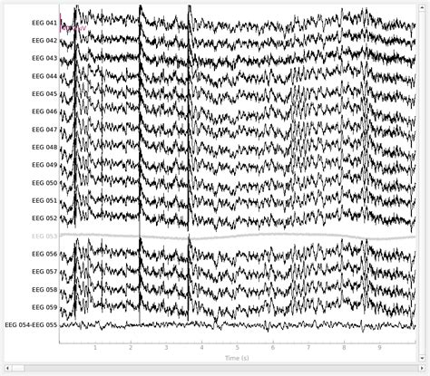 Setting The Eeg Reference — Mne 171 Documentation