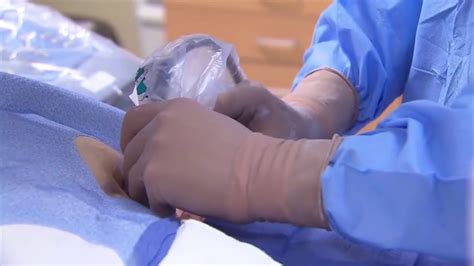 Atherectomy For Peripheral Vascular Disease Part 1 Youtube