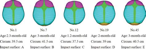 Five Subject Specific Fe Models And Corresponding Impact Surfaces Download Scientific Diagram