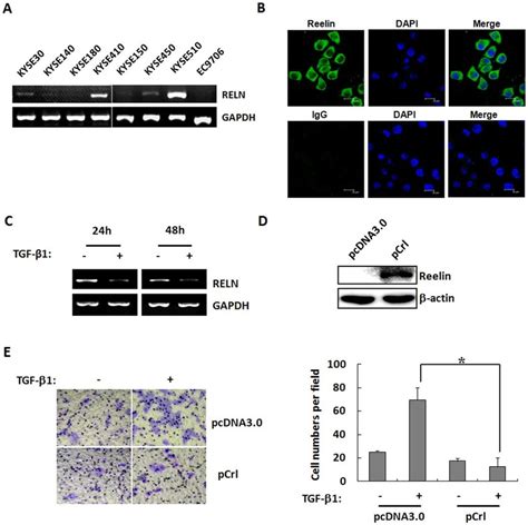 Tgf B1 Suppressed Reln Expression And Transient Transfection Of Reelin Tgf B1 Suppressed Reln Expression And Transient Transfection Of Reelin